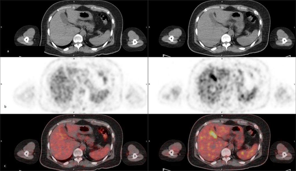 PET Basics 2 - Asian Nuclear Medicine Board (ANMB)
