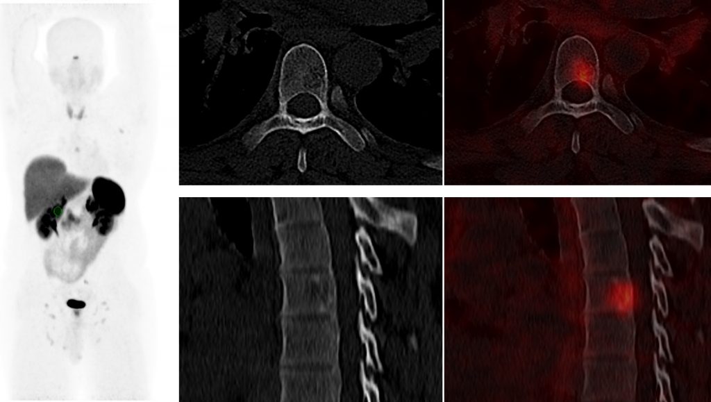 Quiz, skeletal system - Asian Nuclear Medicine Board (ANMB)