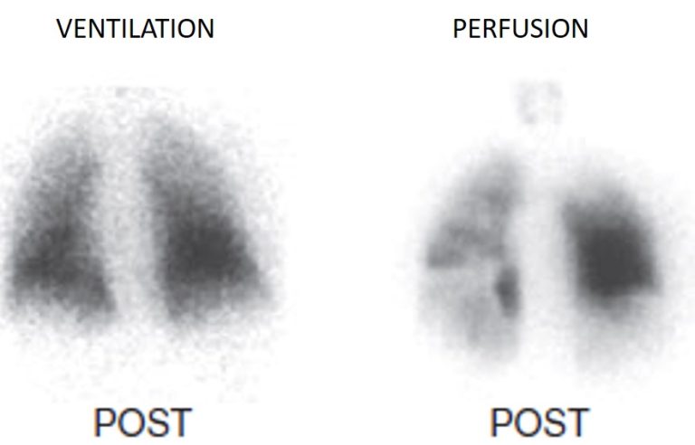 Sample Questions - Asian Nuclear Medicine Board (ANMB)