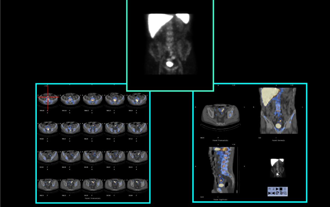 Sample Questions - Asian Nuclear Medicine Board (ANMB)